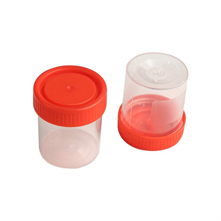 China Customized Sterile Plastic Urine Container Urine Cup 30ml 40ml 60ml 100ml 120ml ...